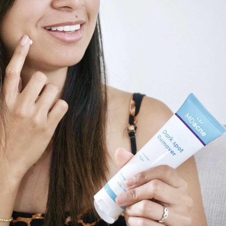 The best hyperpigmentation treatment for black skin | MDacne