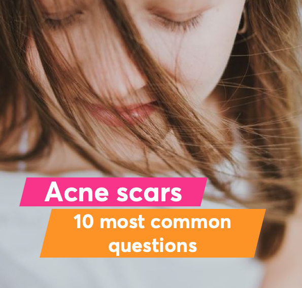 The 10 most common acne scars questions | MDacne
