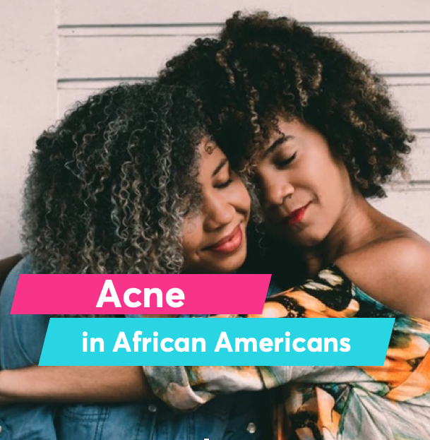 Acne in African Americans | MDacne