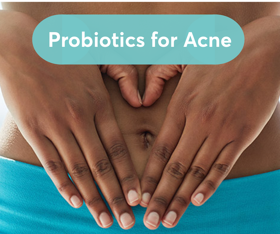 Should You Take Probiotics For Acne? | MDacne