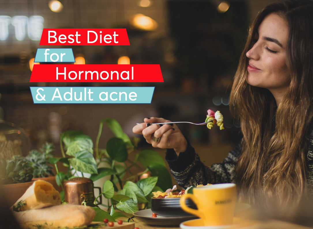 Best diet for women with adult hormonal acne | MDacne