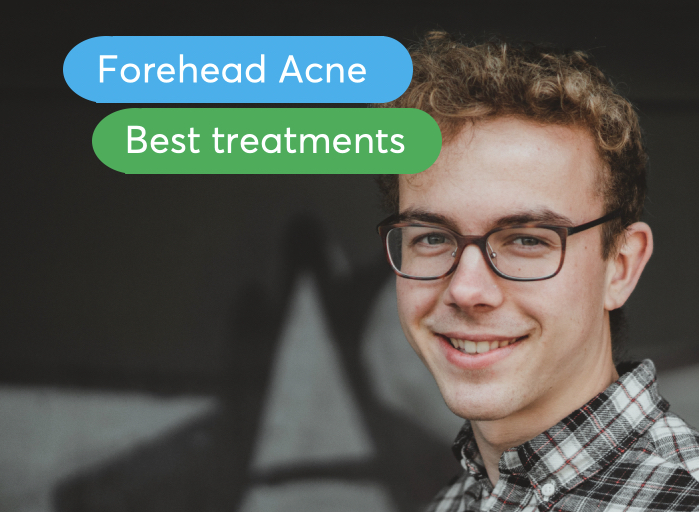 Forehead Acne Causes And Treatments | MDacne